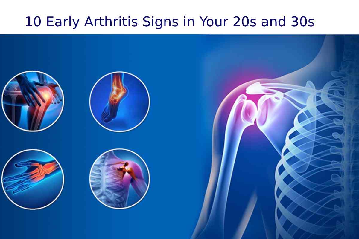 Joint Pain in Your 20s? Early Arthritis Signs to Know